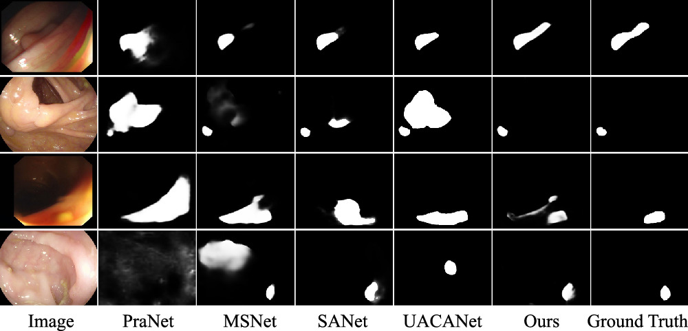 Polyp segmentation with interference filtering and dynamic uncertainty ...