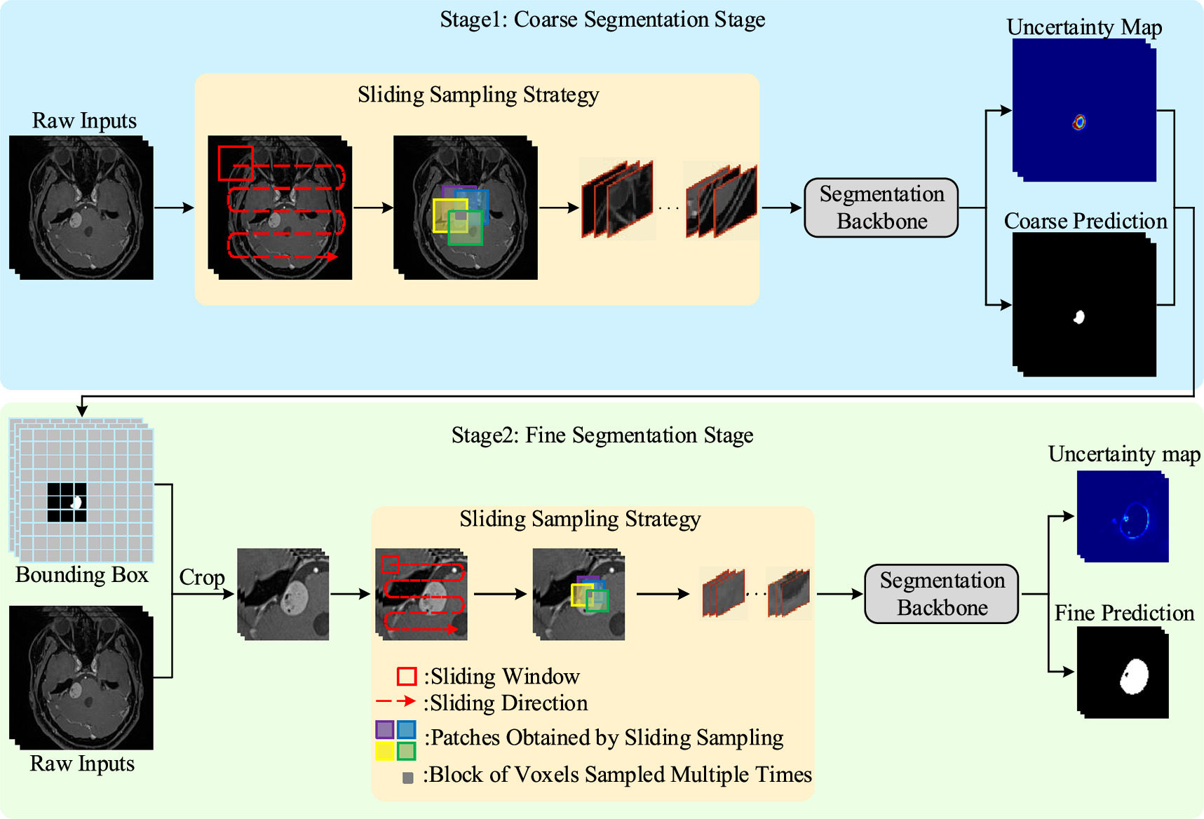 Sliding transformer with uncertainty estimation for vestibular ...