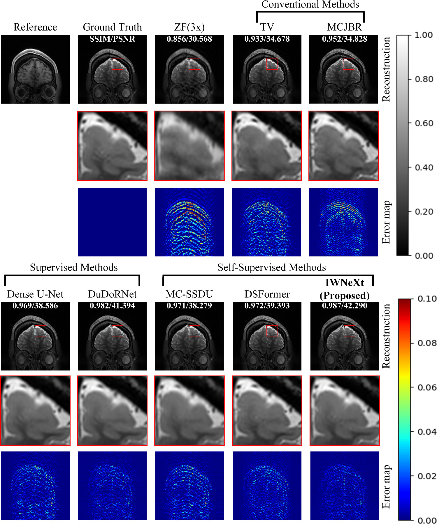 IWNeXt: an image-wavelet domain ConvNeXt-based network for self-supervised multi-contrast MRI ...