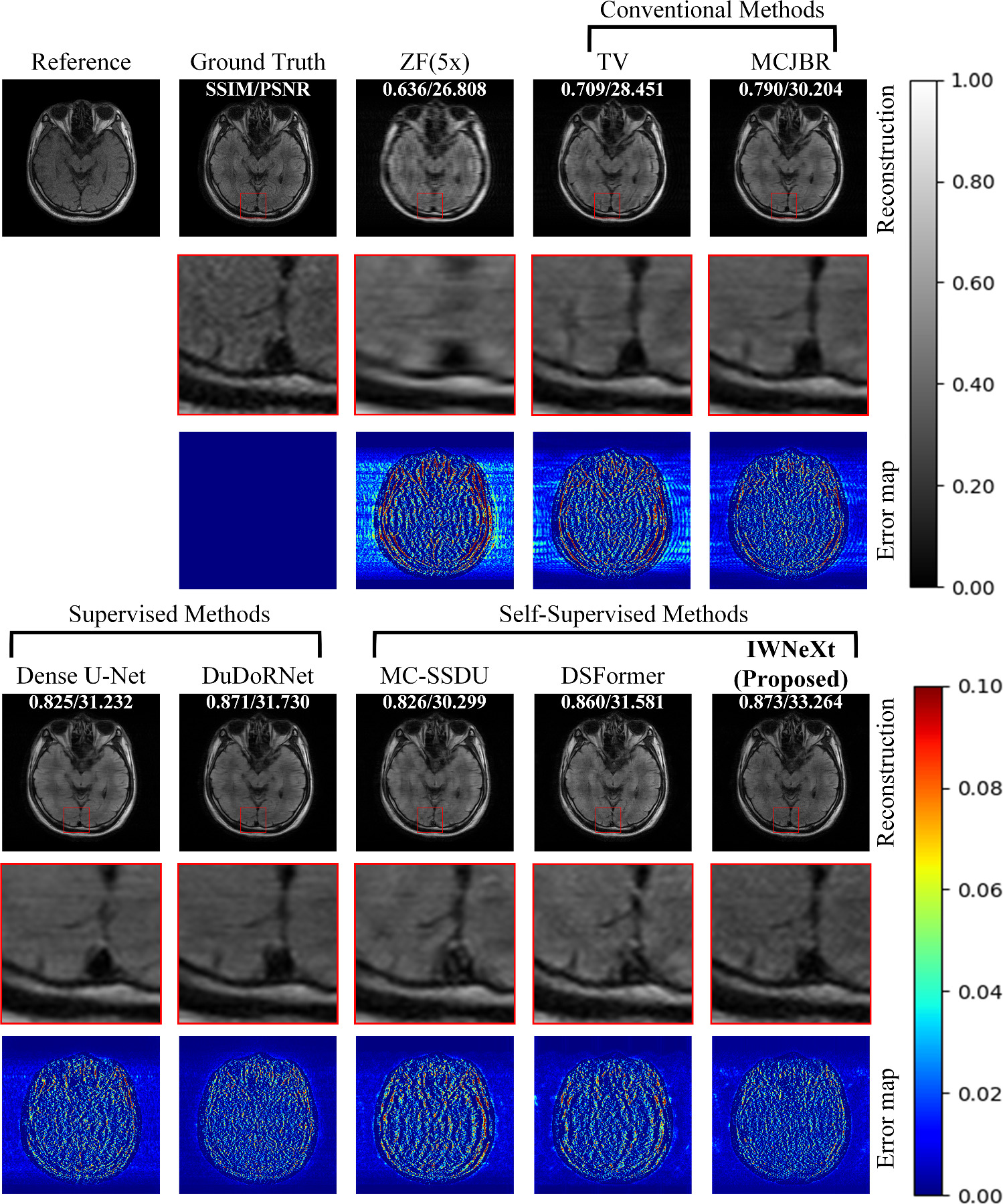 IWNeXt: an image-wavelet domain ConvNeXt-based network for self ...