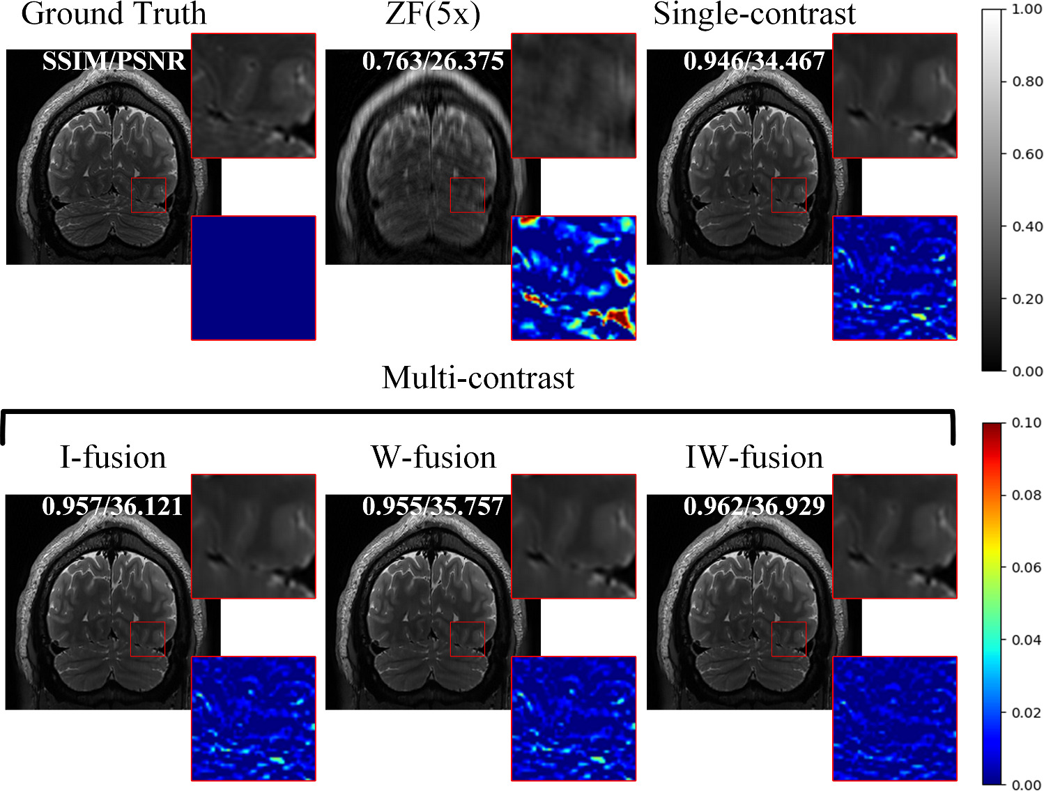 IWNeXt: an image-wavelet domain ConvNeXt-based network for self-supervised multi-contrast MRI ...