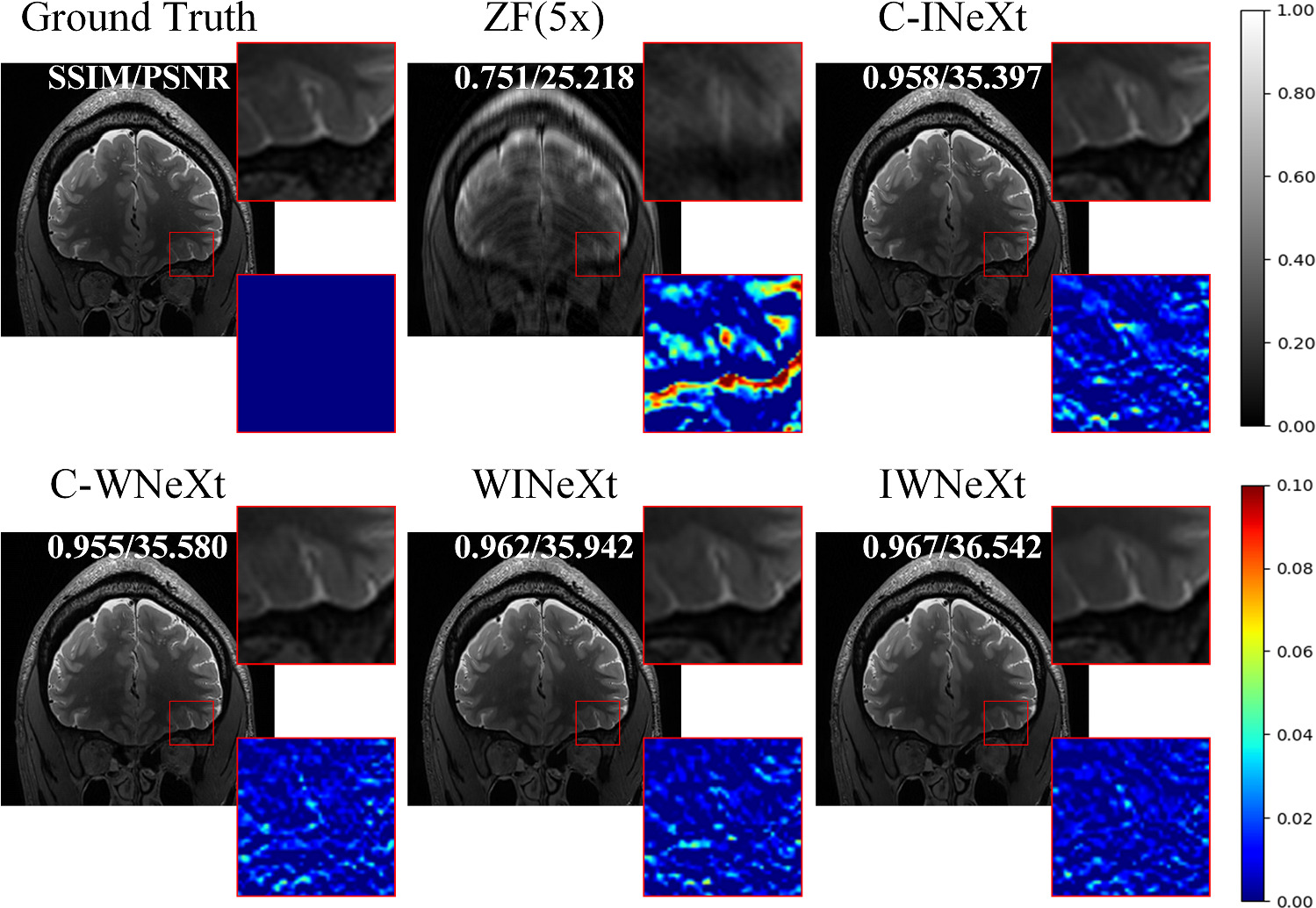 IWNeXt: an image-wavelet domain ConvNeXt-based network for self-supervised multi-contrast MRI ...