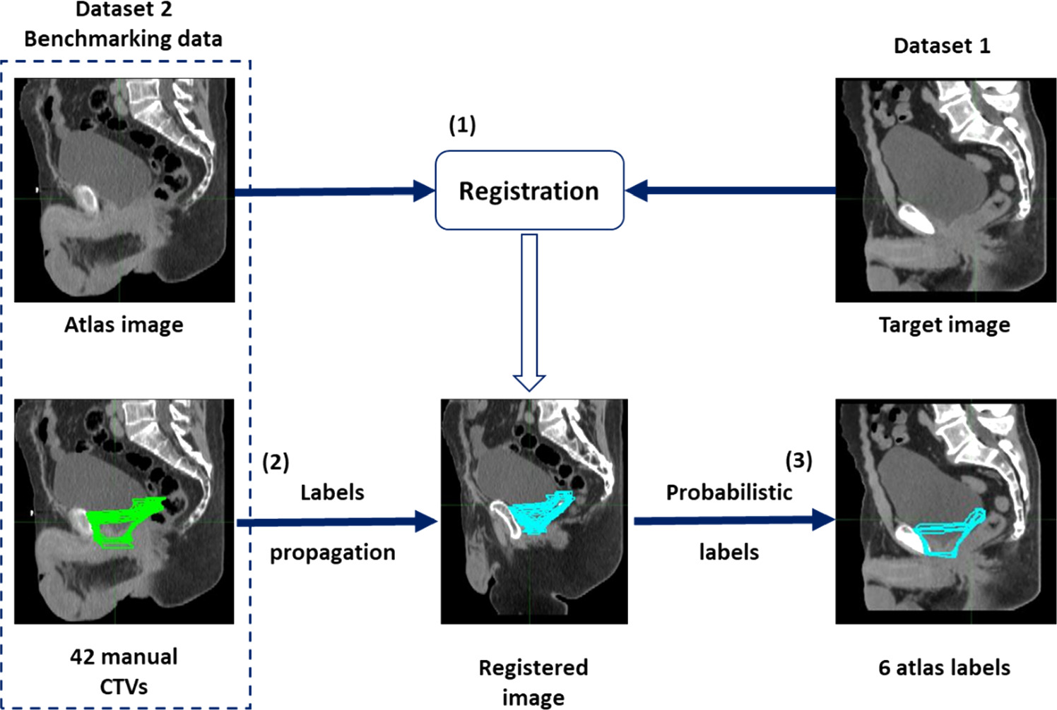 Evaluating the relationship between contouring variability and modelled ...