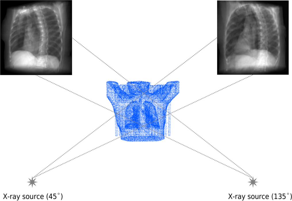 XTransCT: ultra-fast volumetric CT reconstruction using two orthogonal ...
