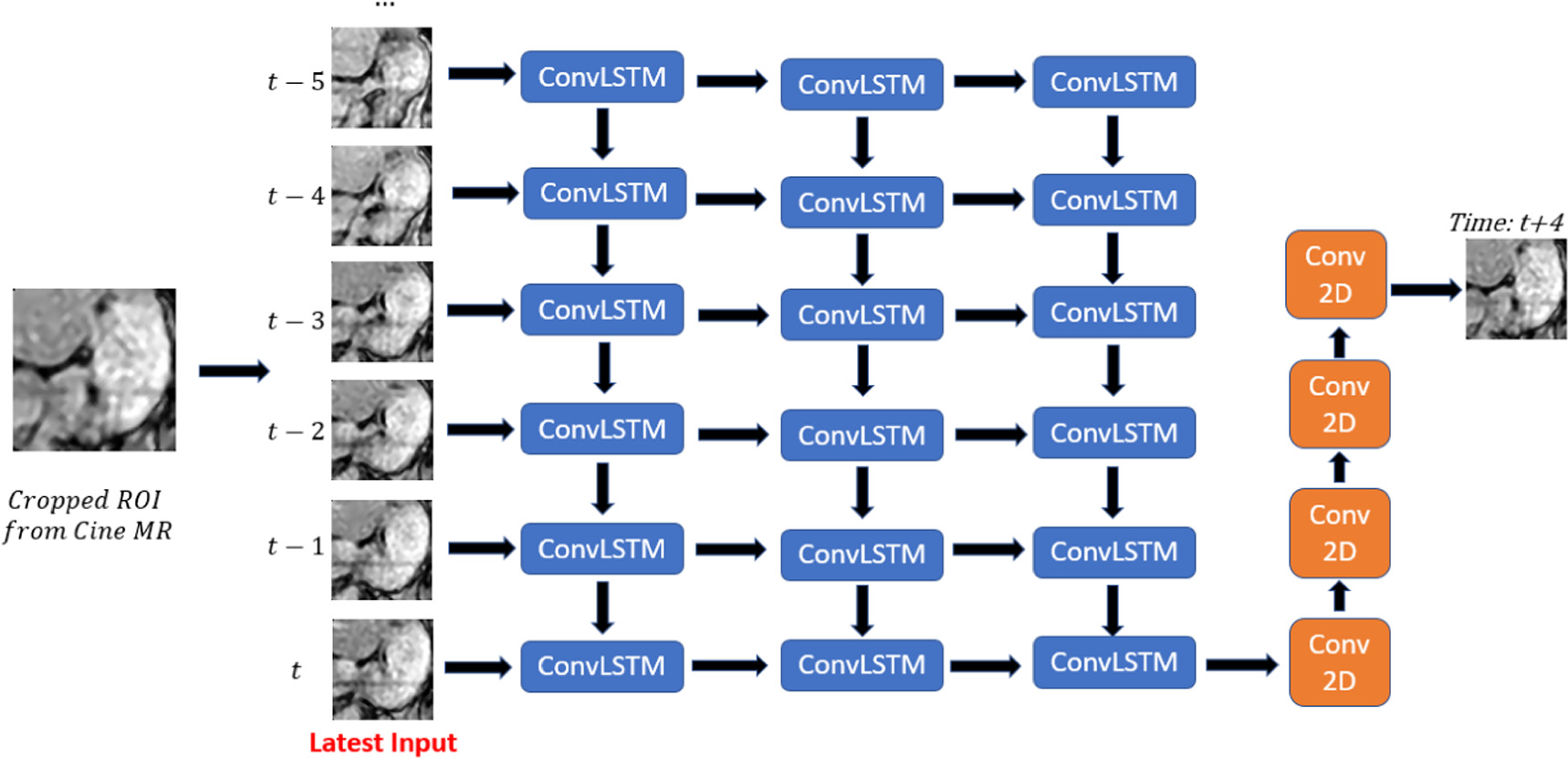 Convolutional LSTM model for cine image prediction of abdominal motion ...