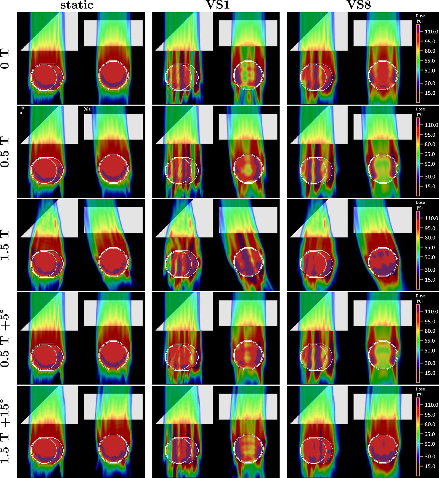 The impact of motion on onboard MRI-guided pencil beam scanned proton ...