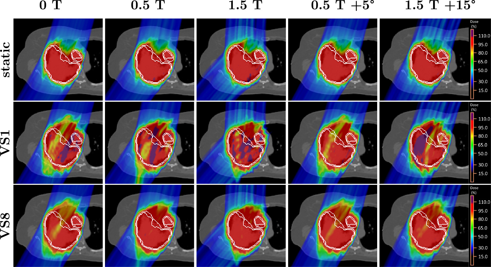 The impact of motion on onboard MRI-guided pencil beam scanned proton ...