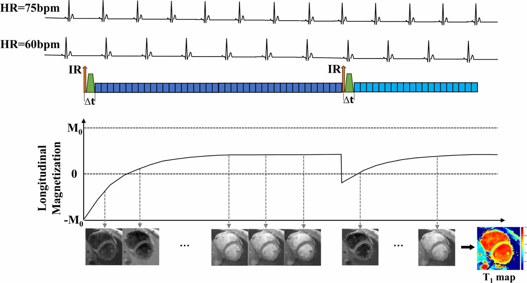 Myocardial T1 mapping at 5T using multi-inversion recovery real-time ...