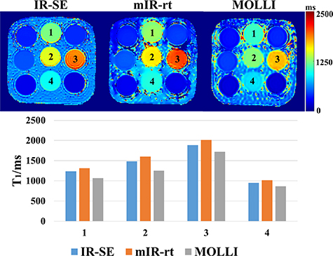 Myocardial T1 mapping at 5T using multi-inversion recovery real-time ...
