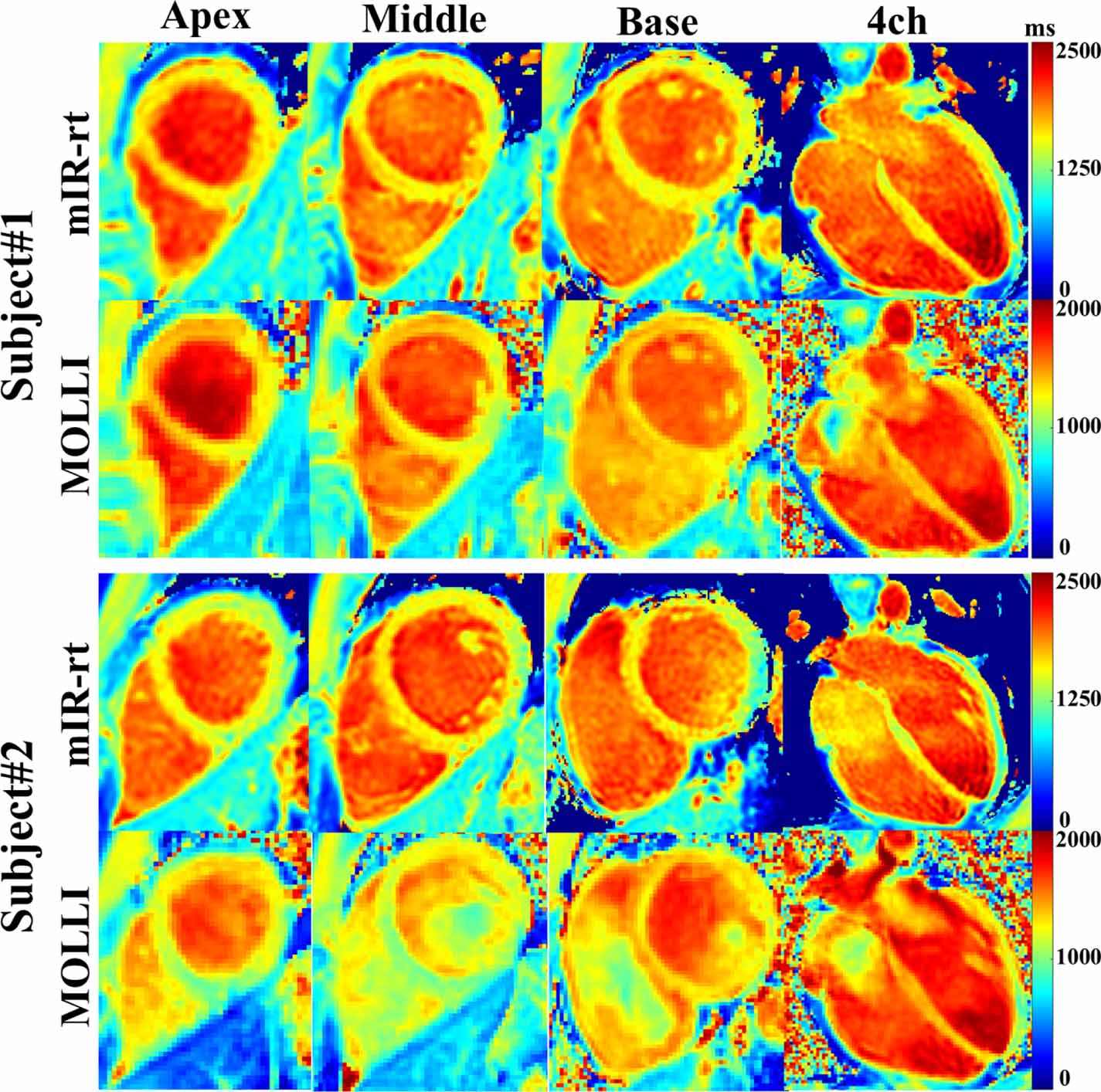 Myocardial T1 mapping at 5T using multi-inversion recovery real-time ...