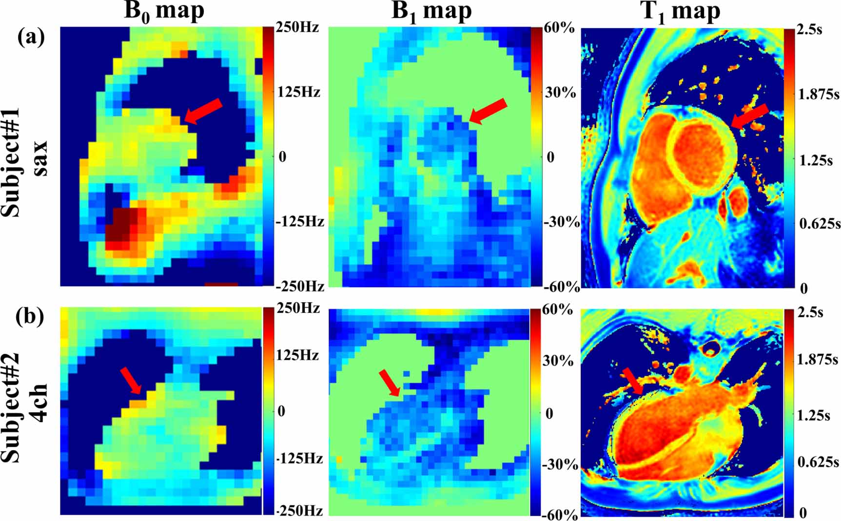 Myocardial T1 mapping at 5T using multi-inversion recovery real-time ...
