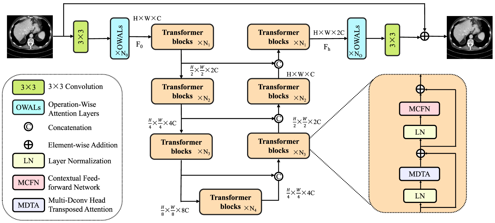 CT-Denoimer: efficient contextual transformer network for low-dose CT ...