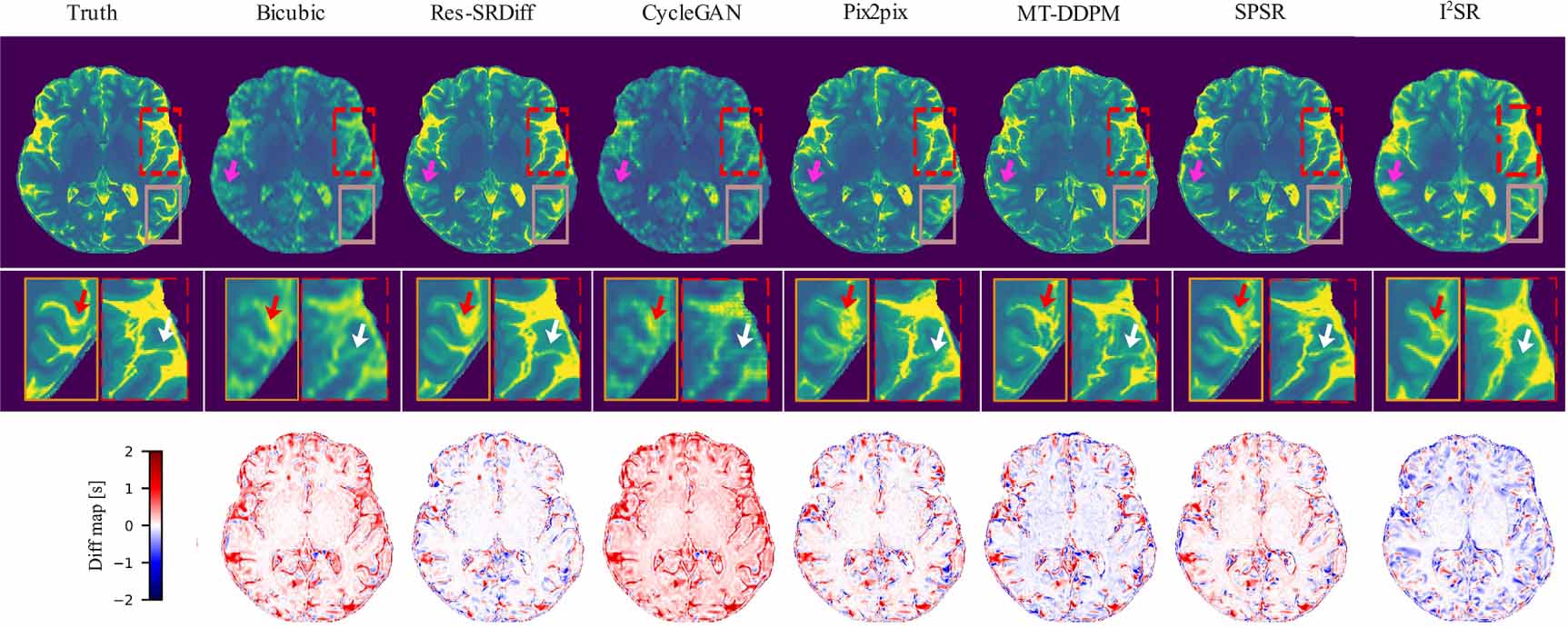 MRI super-resolution reconstruction using efficient diffusion ...