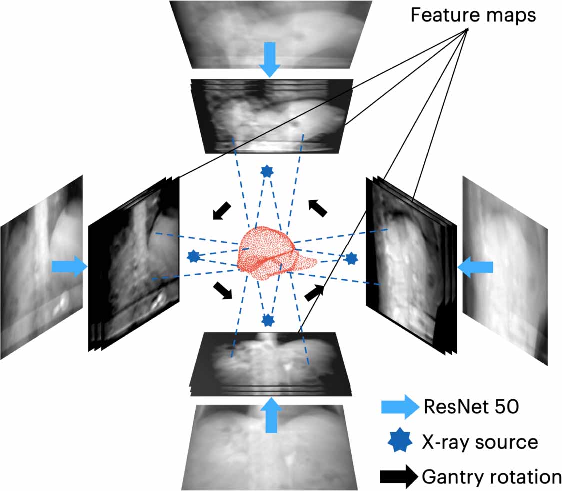 A conditional point cloud diffusion model for deformable liver motion tracking via a single ...