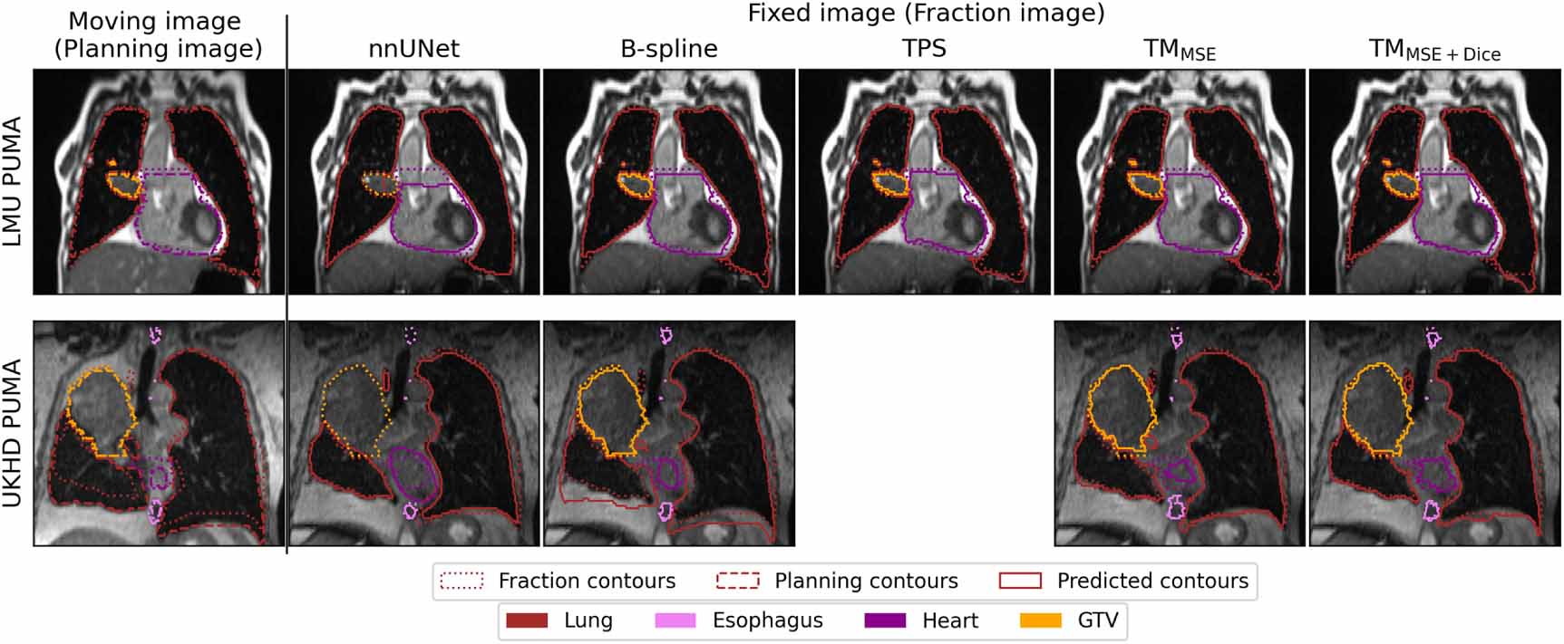 Deep learning-based contour propagation in magnetic resonance imaging ...