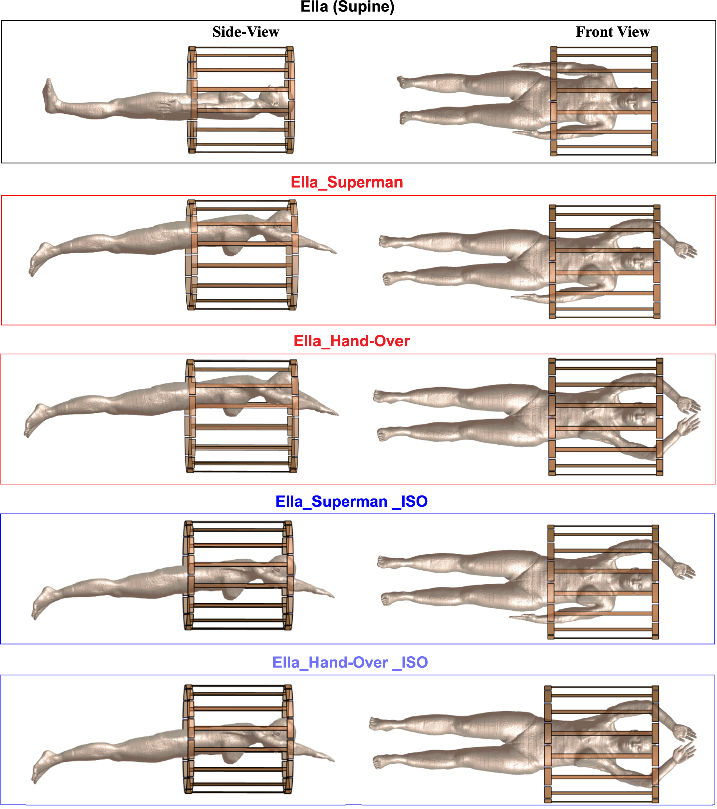 Breast MRI in the prone position: impact on RF-induced heating of ...