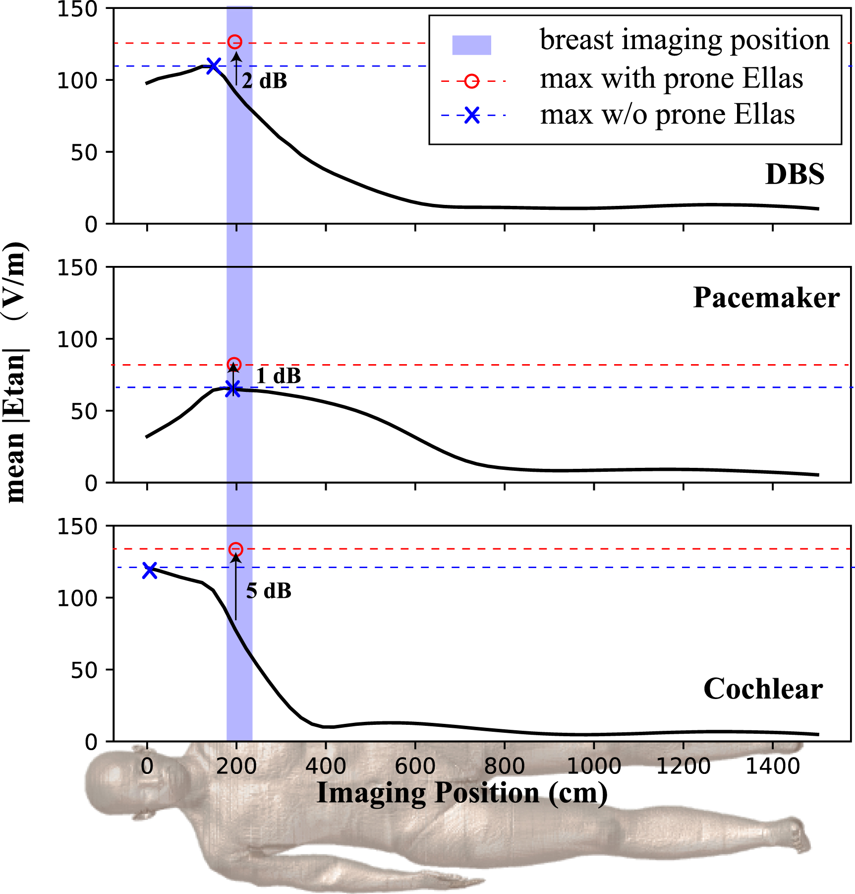 Breast MRI in the prone position: impact on RF-induced heating of ...