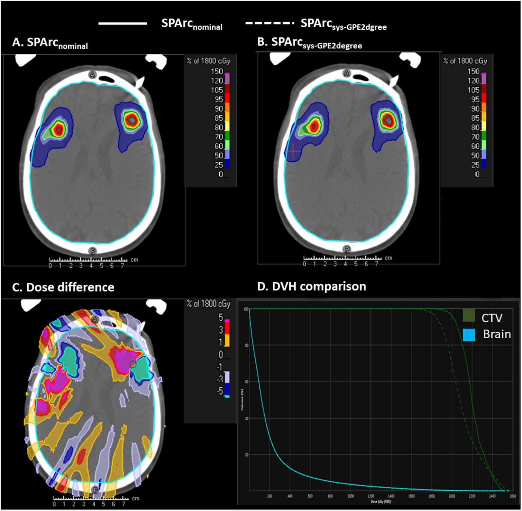Investigate gantry position error effect on dynamic spot-scanning ...