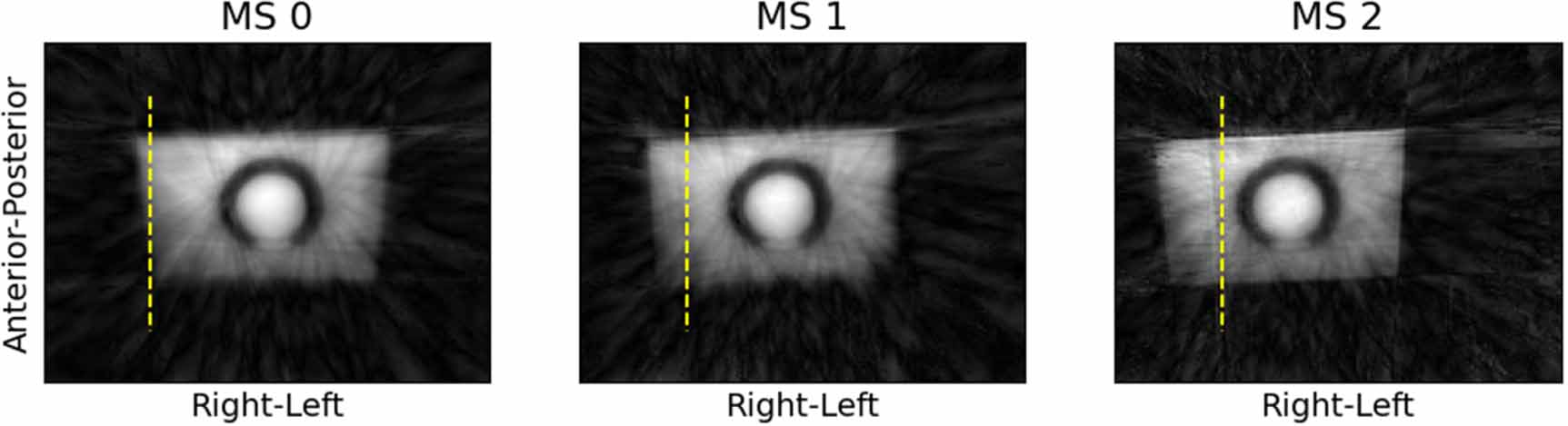 Efficient motion-corrected image reconstruction for 3D cardiac MRI ...