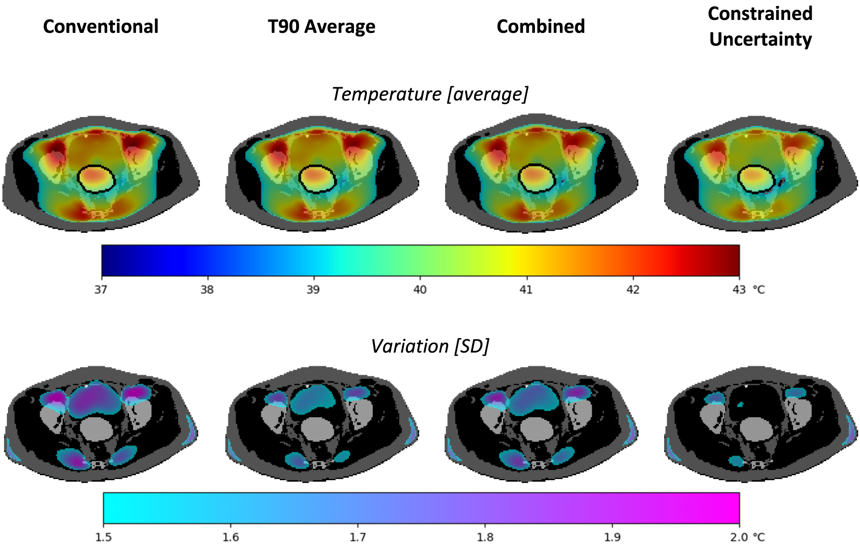 Robust stochastic optimisation strategies for locoregional hyperthermia ...