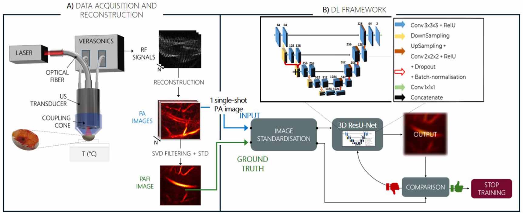Deep learning-enhanced 3D real-time photoacoustic imaging using ...