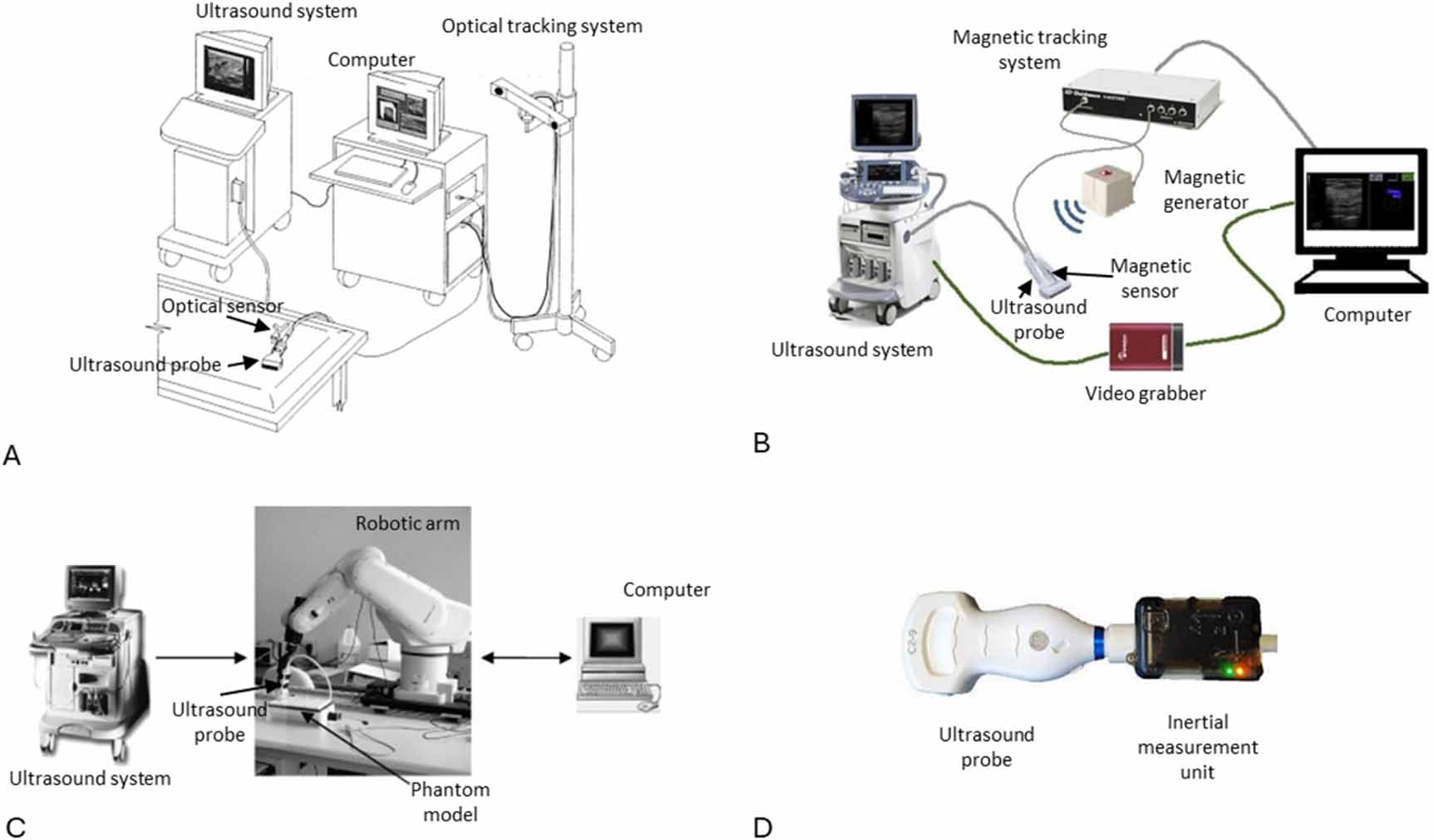 Three-dimensional ultrasound imaging: a review of the technology ...