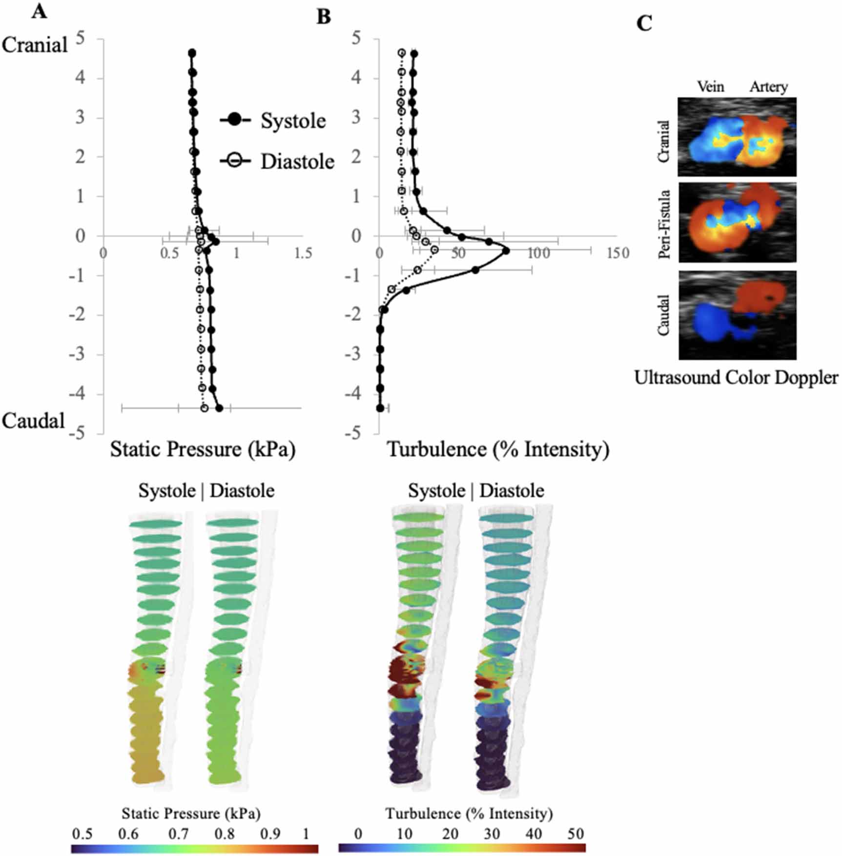 Turbulence drives arteriovenous remodeling: an experimentally validated ...