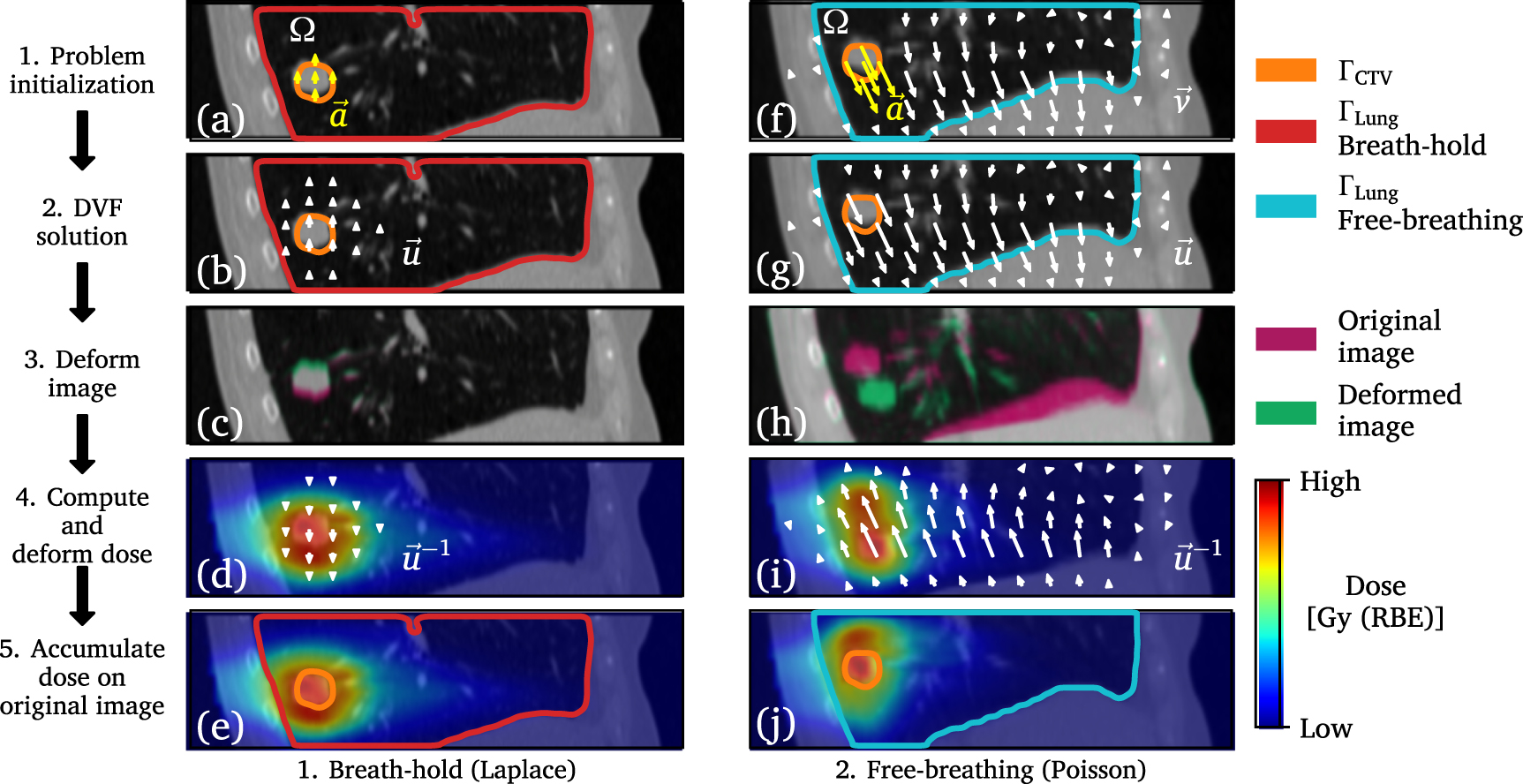 Robust treatment planning and displacement vector field editing for the ...