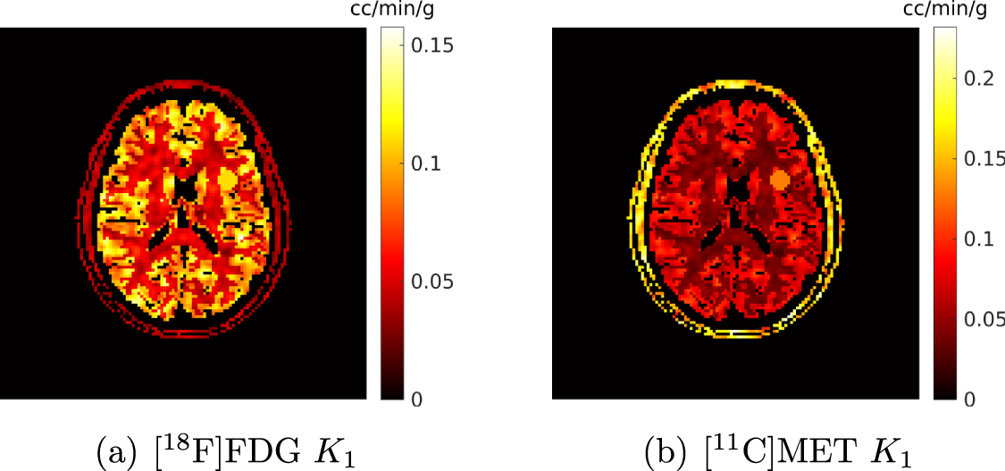 Self-supervised parametric map estimation for multiplexed PET with a deep image prior - IOPscience
