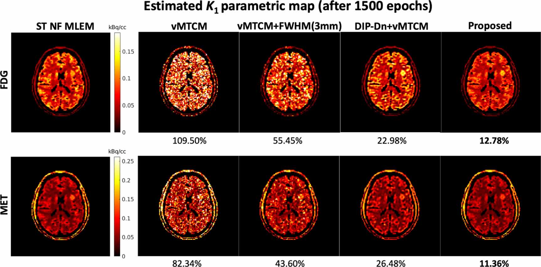 Self-supervised parametric map estimation for multiplexed PET with a deep image prior - IOPscience