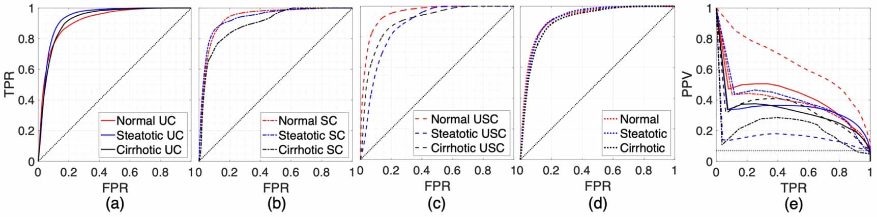 Real-time control of radiofrequency ablation using three-dimensional ...