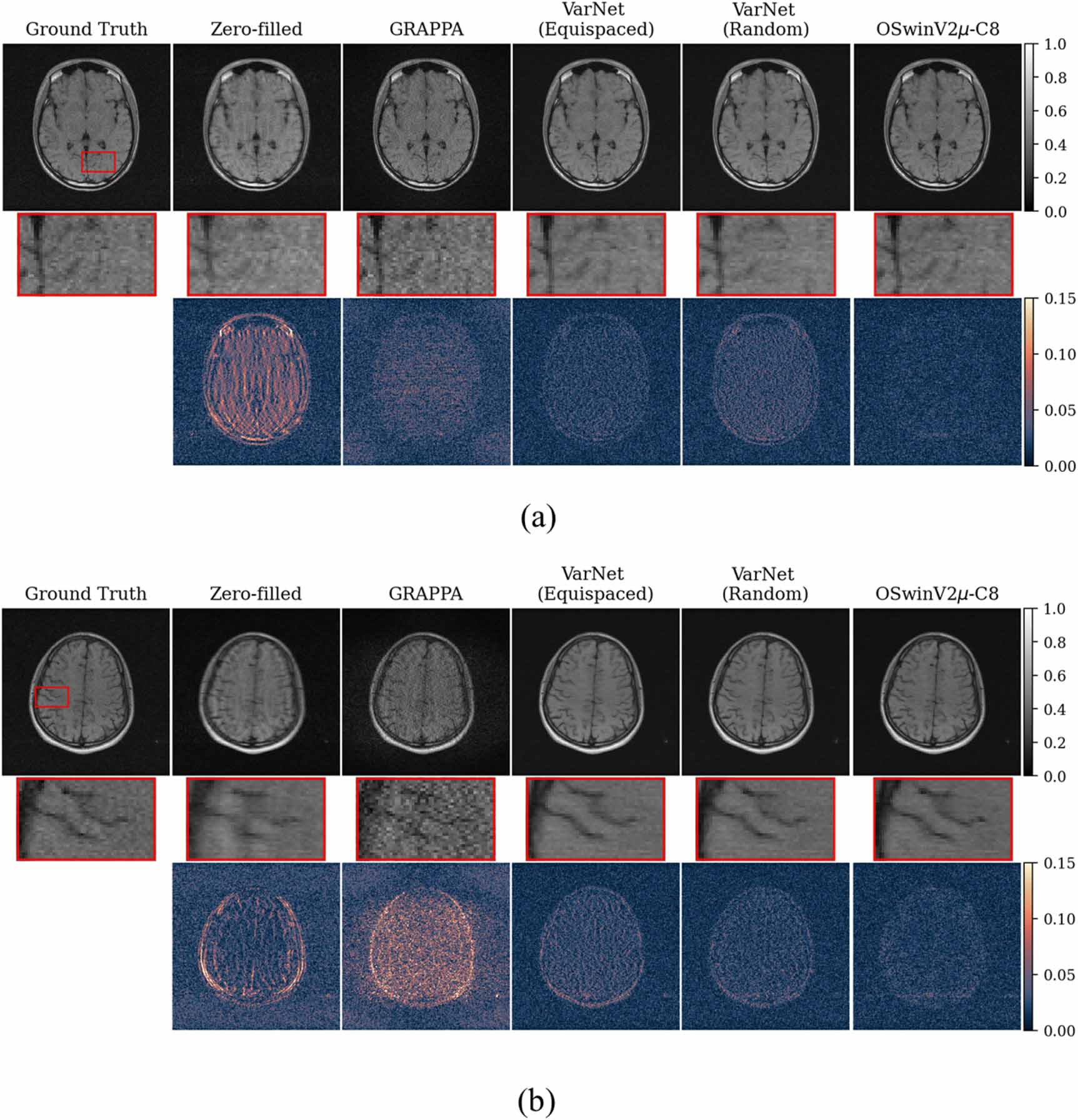 Multi-channel MRI reconstruction using cascaded Swinμ transformers with ...
