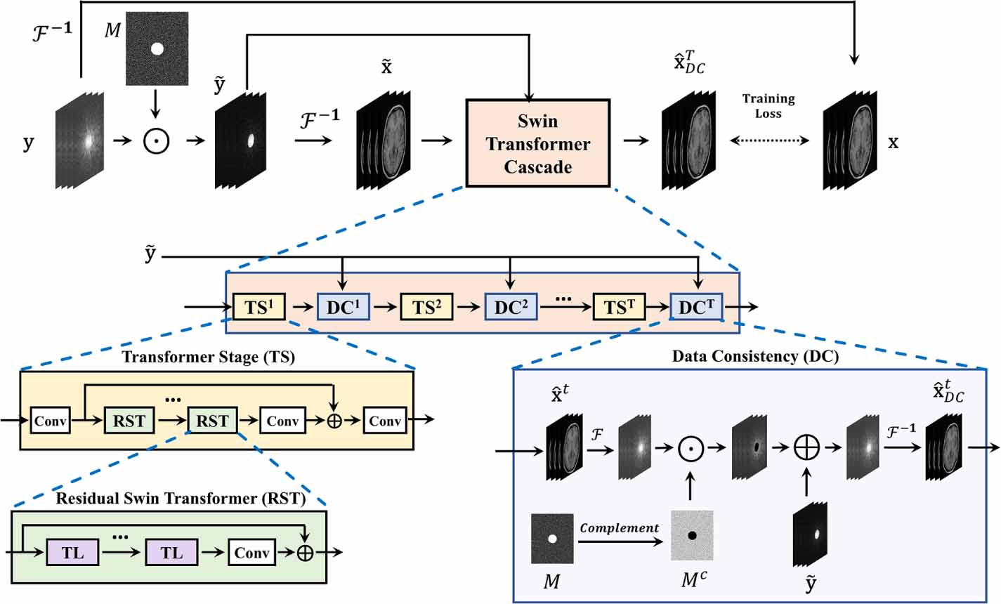 Multi-channel MRI reconstruction using cascaded Swinμ transformers with ...