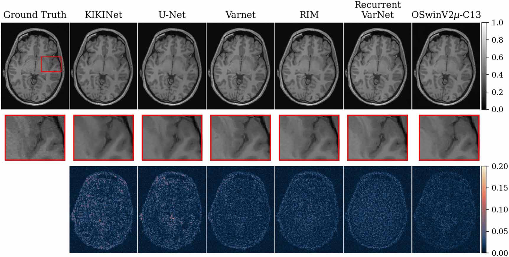 Multi-channel MRI reconstruction using cascaded Swinμ transformers with ...