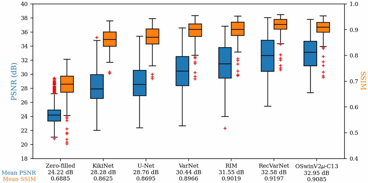Multi-channel MRI reconstruction using cascaded Swinμ transformers with ...
