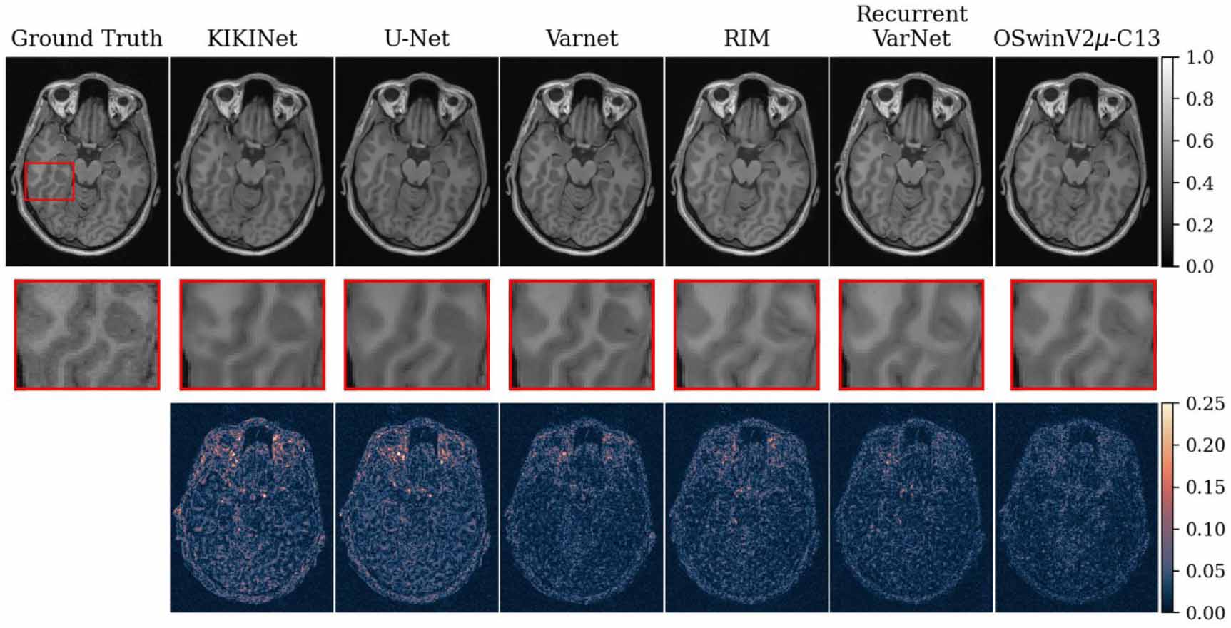 Multi-channel MRI reconstruction using cascaded Swinμ transformers with ...