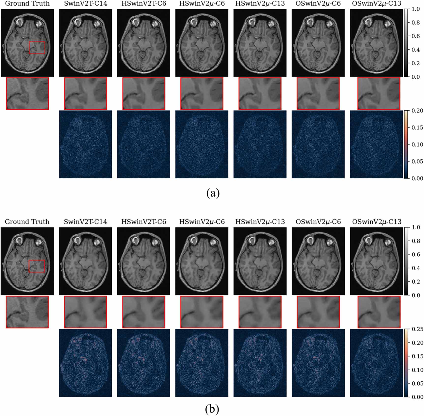 Multi-channel MRI reconstruction using cascaded Swinμ transformers with ...