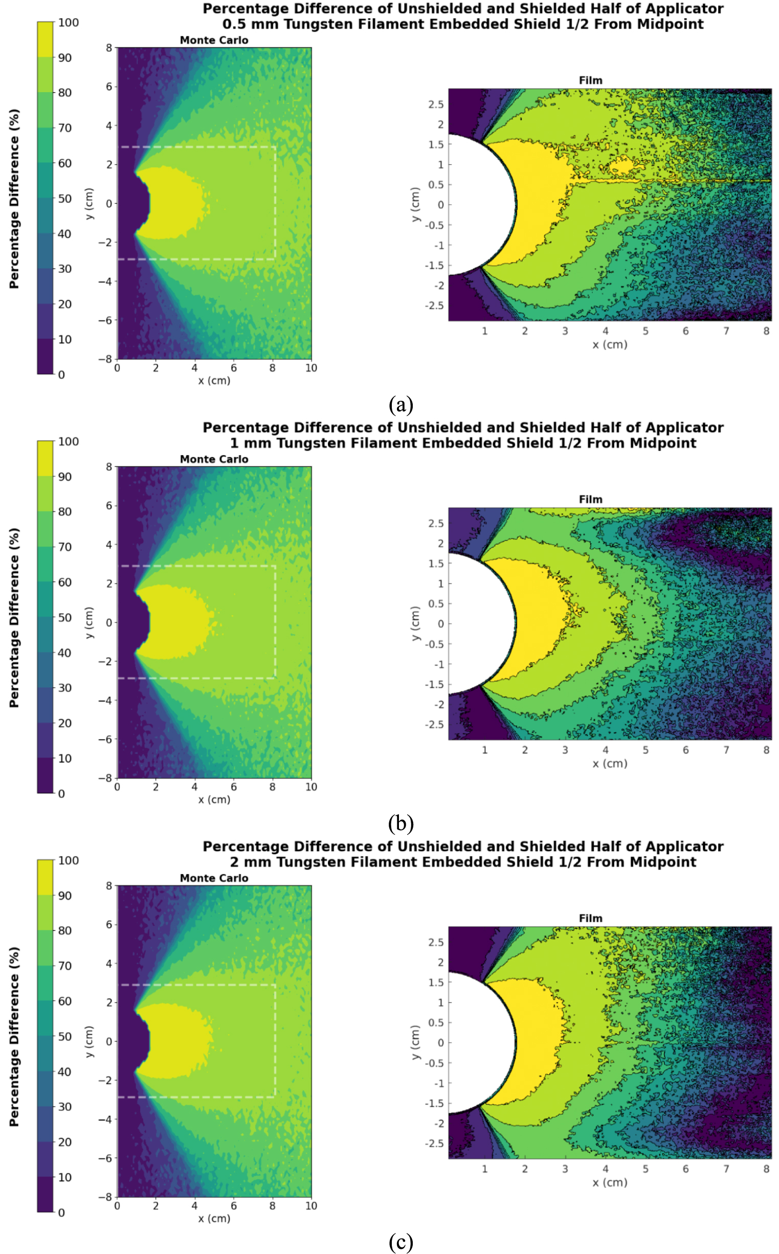 Development and dosimetric evaluation of a modulated intraoperative ...