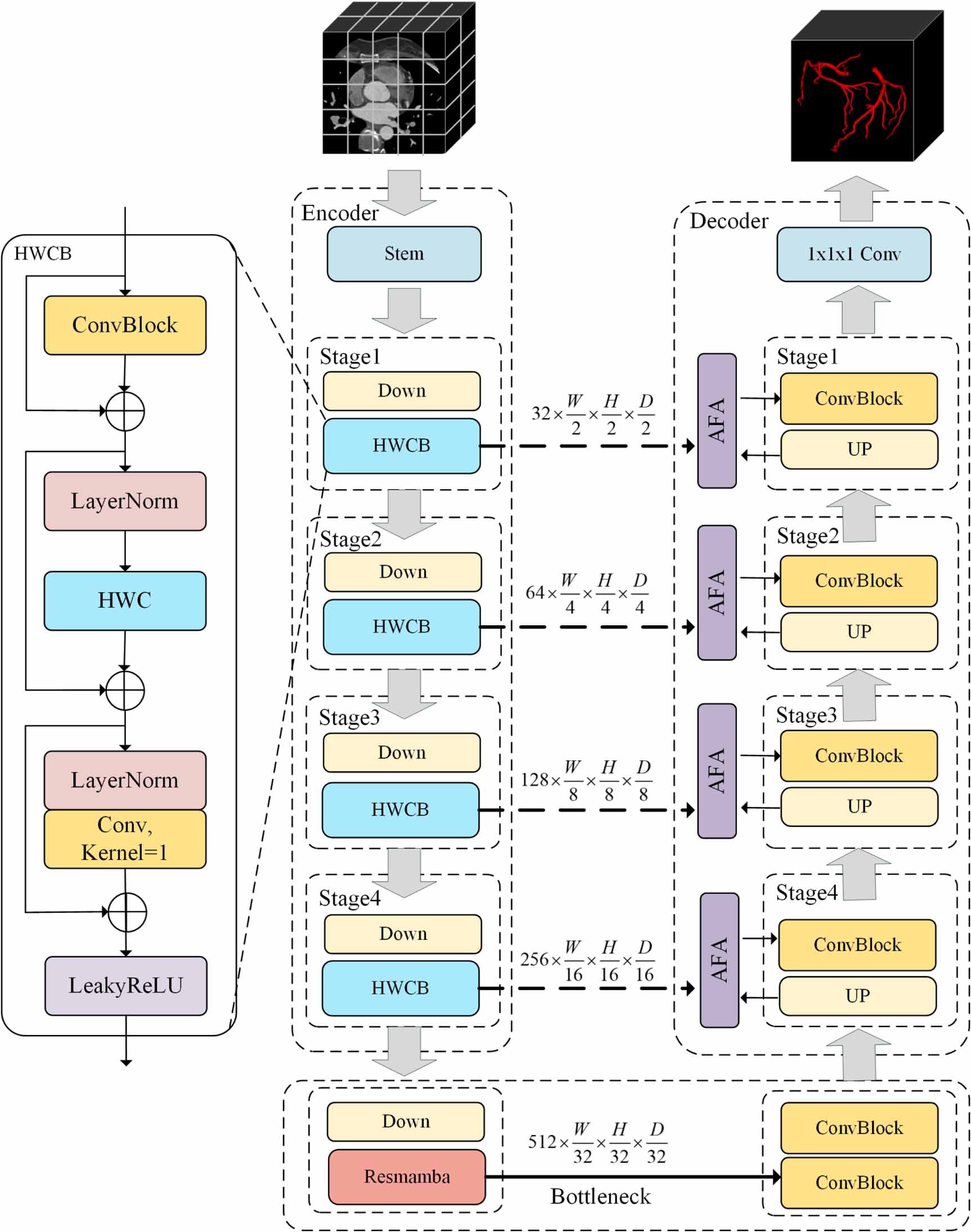 HWA-ResMamba: automatic segmentation of coronary arteries based on ...