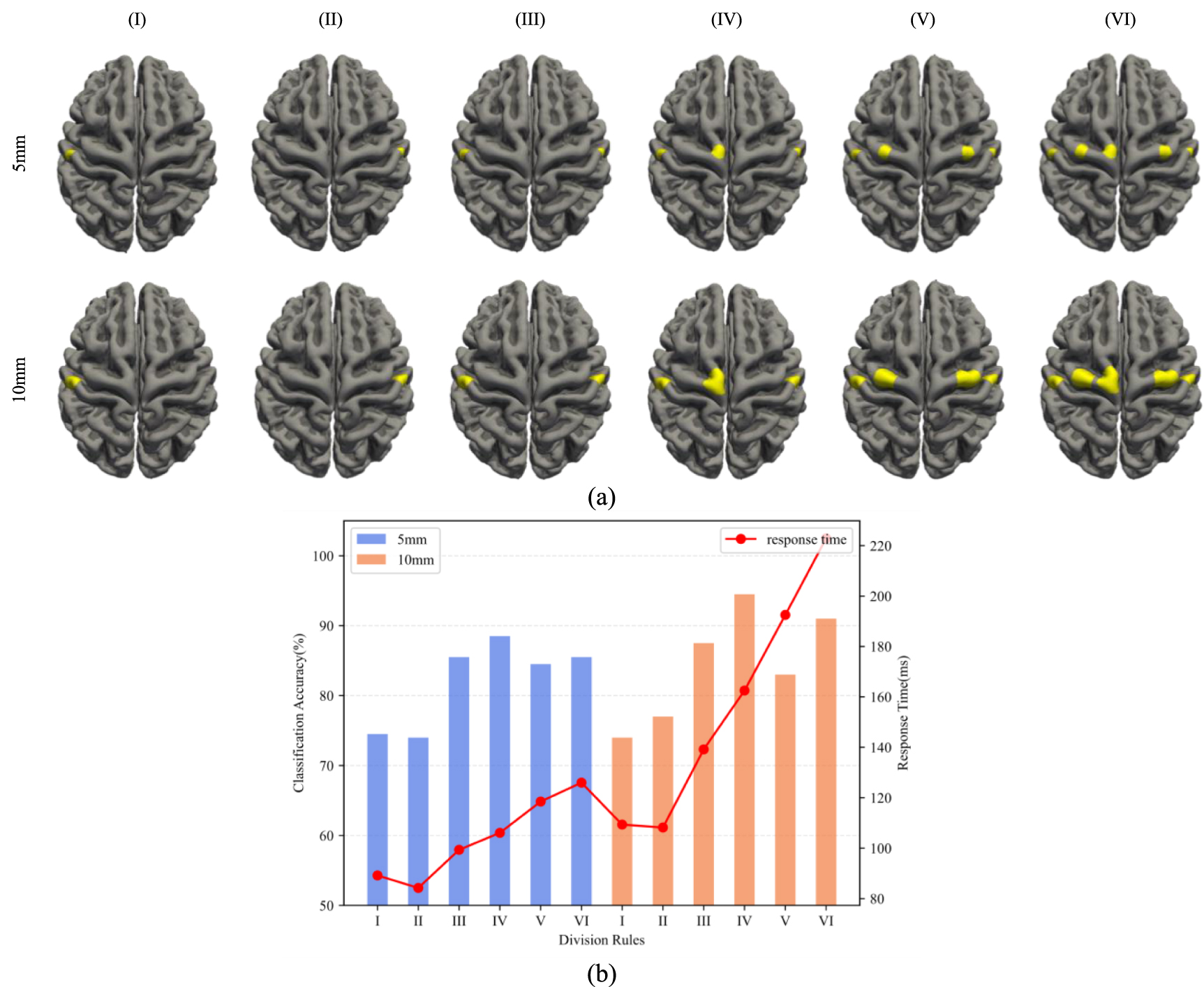 Multi-view collaborative ensemble classification for EEG signals based ...