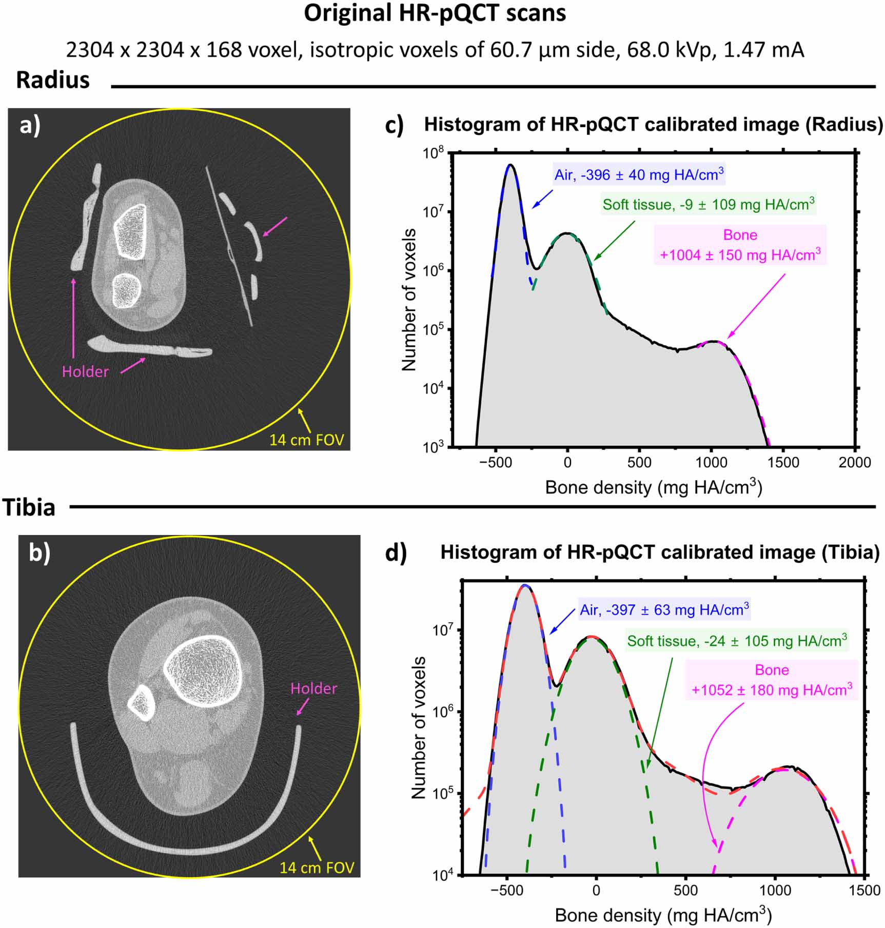 Absorbed and effective dose estimates in HR-pQCT of the distal radius ...