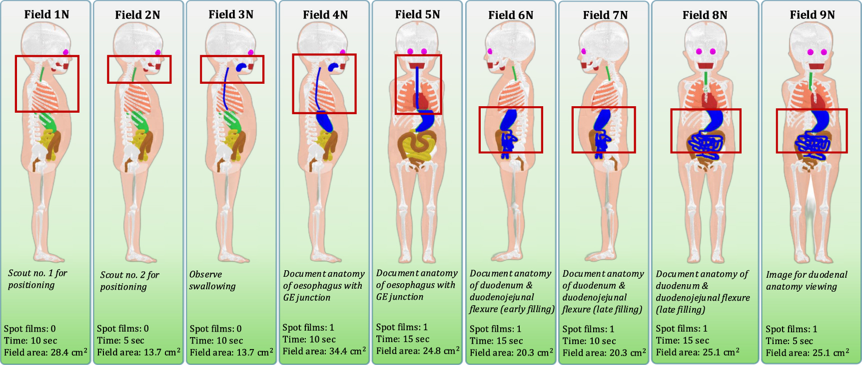 Impact of contrast agents on organ dosimetry in paediatric diagnostic ...