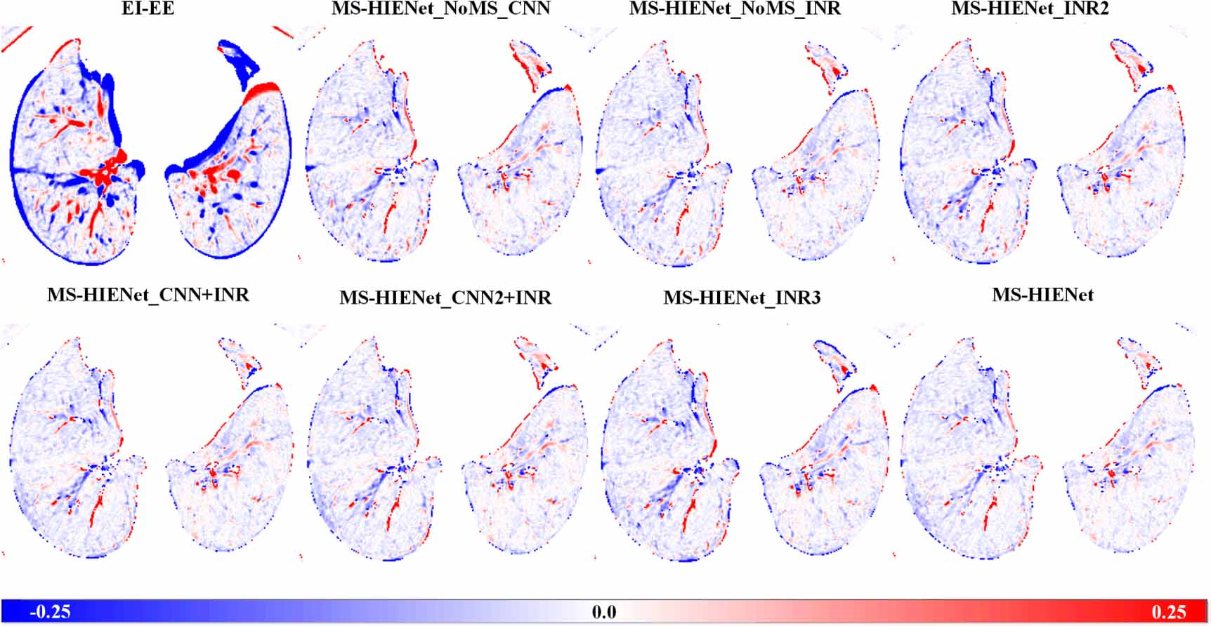MS-HIENet: multi-scale hybrid implicit-explicit registration network ...