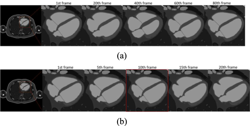 Deep-learning-based spectral motion artifact correction on photon ...