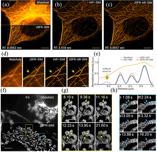 Real-time super-resolution structured illumination microscopy: current ...
