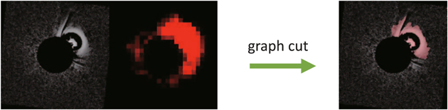A New Automatic Tool for CME Detection and Tracking with Machine ...