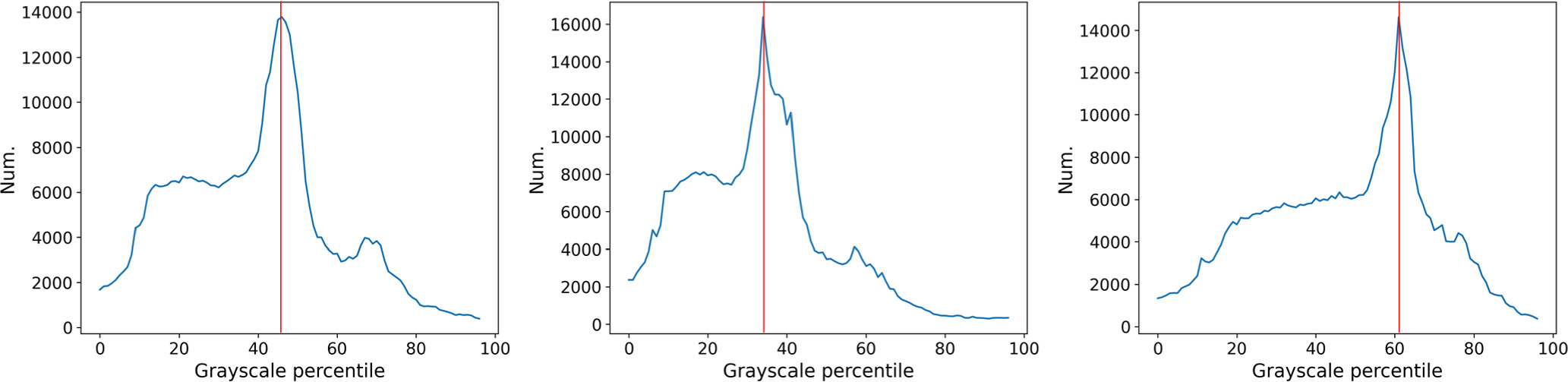 CME Velocity Field Calculation Model Based on an Unsupervised ...