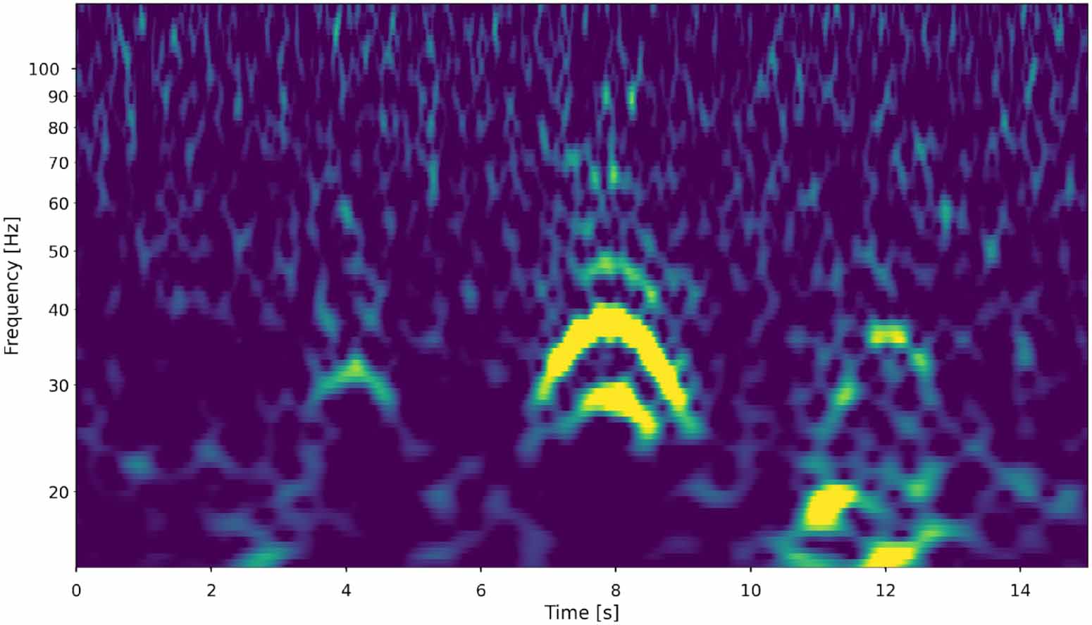 ArchEnemy: removing scattered-light glitches from gravitational wave ...