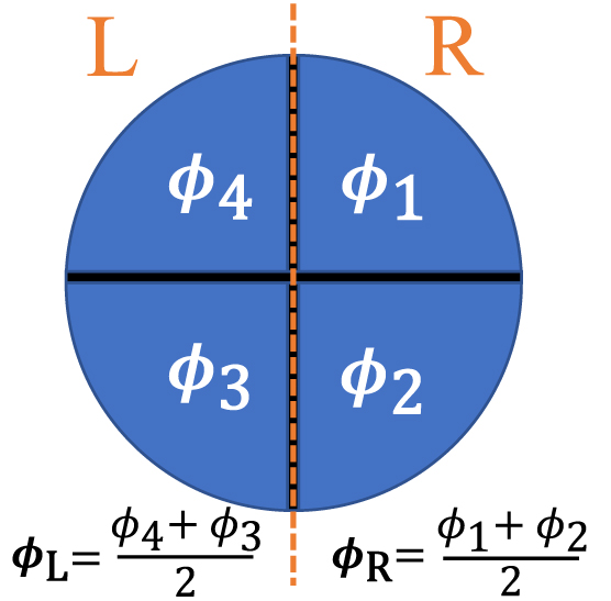 Impact of phase signal formulations on tilt-to-length coupling noise in ...