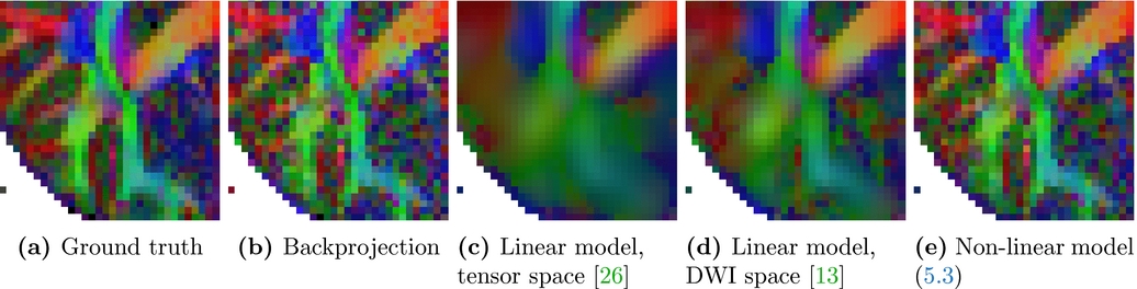 A primal–dual hybrid gradient method for nonlinear operators with applications to MRI - IOPscience